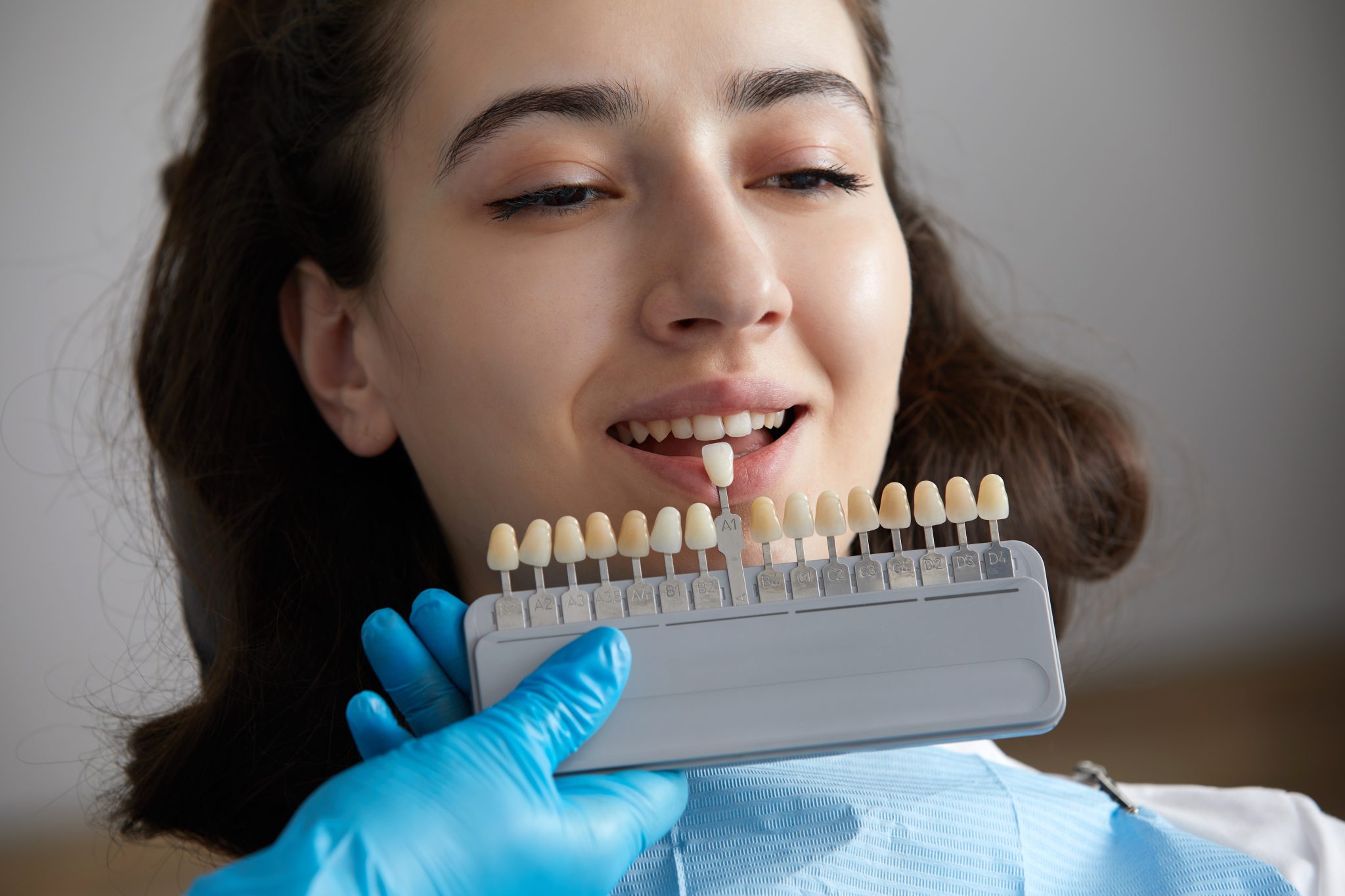 A Practical Guide to Choosing the Right Veneer Shade | Ashburton Dental ...